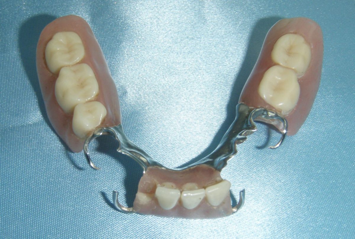 Các Loại Hàm Tháo Lắp Có Thể Bạn Chưa Biết